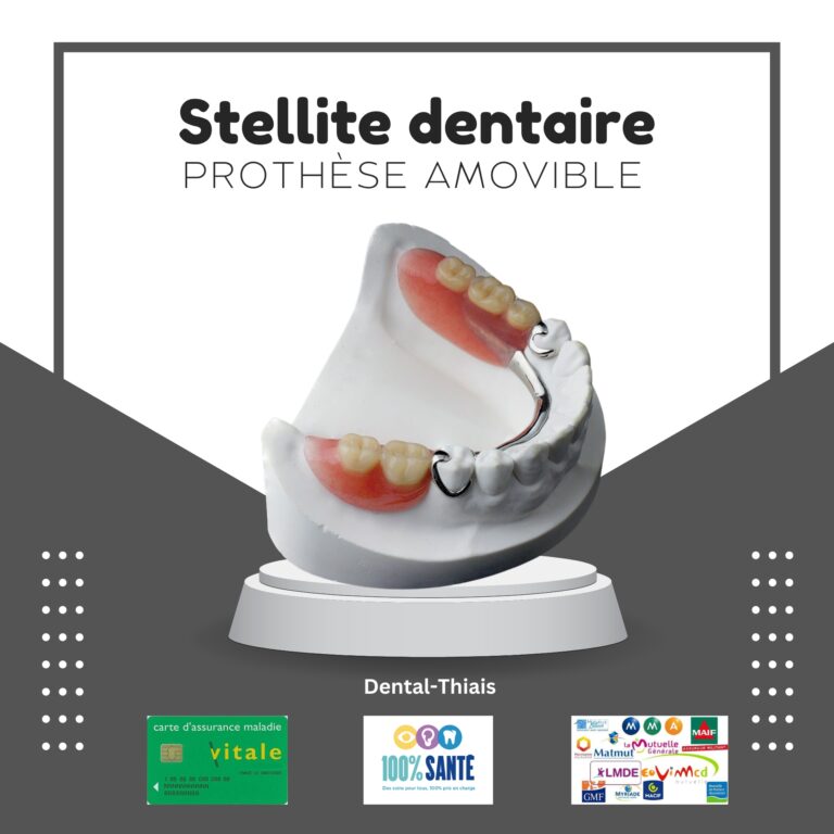 Stellite dentaire : Comprendre et choisir la prothèse adaptée