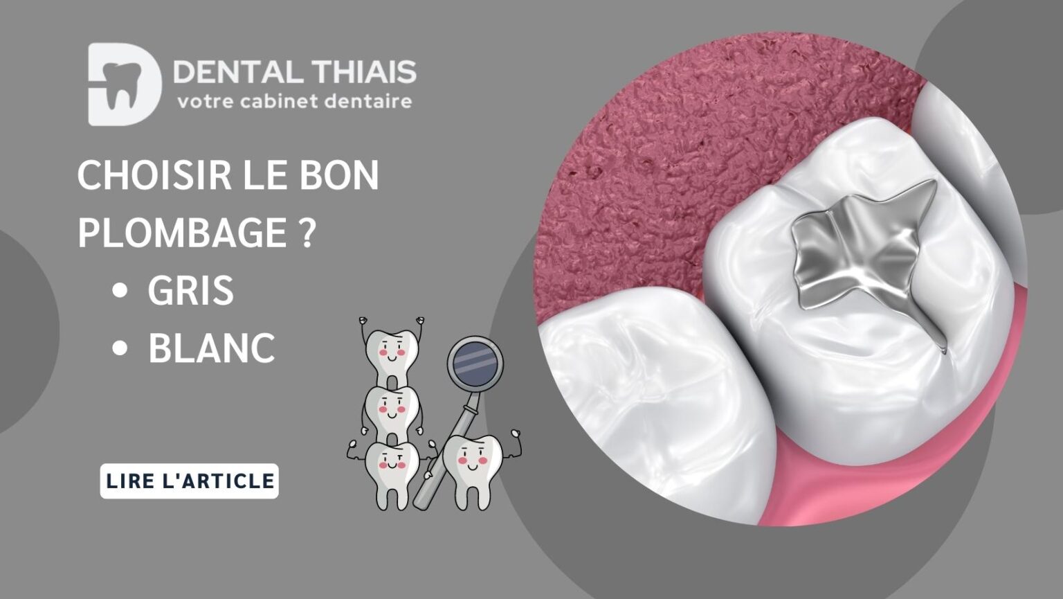 Plombages dentaires : amalgame, composite ou céramique - avantages ...