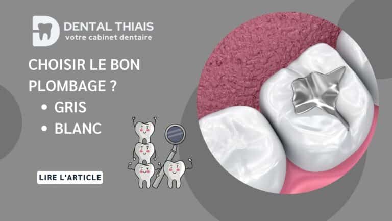 Plombages dentaires : amalgame, composite ou céramique - avantages ...